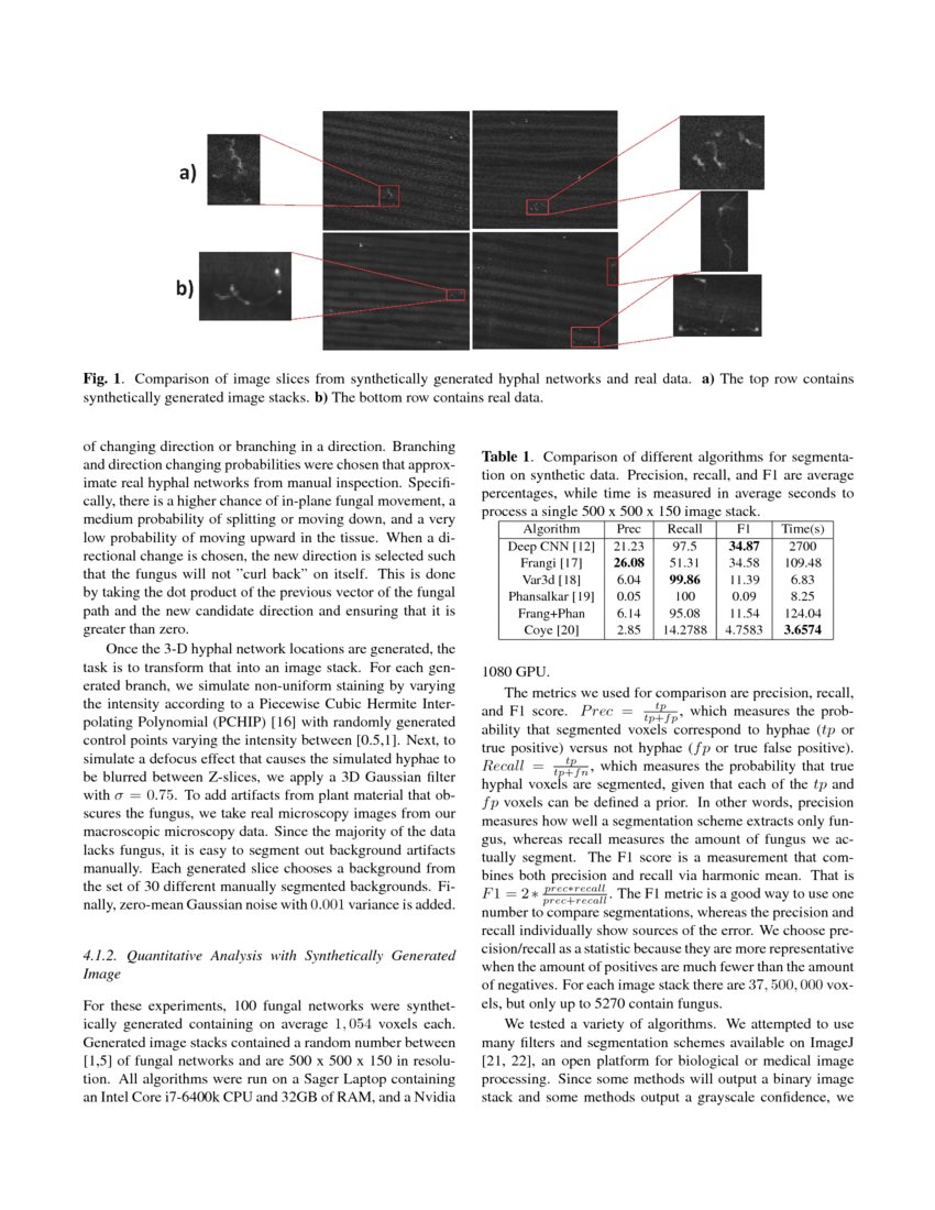 Three-Dimensional Segmentation of Vesicular Networks of Fungal Hyphae ...