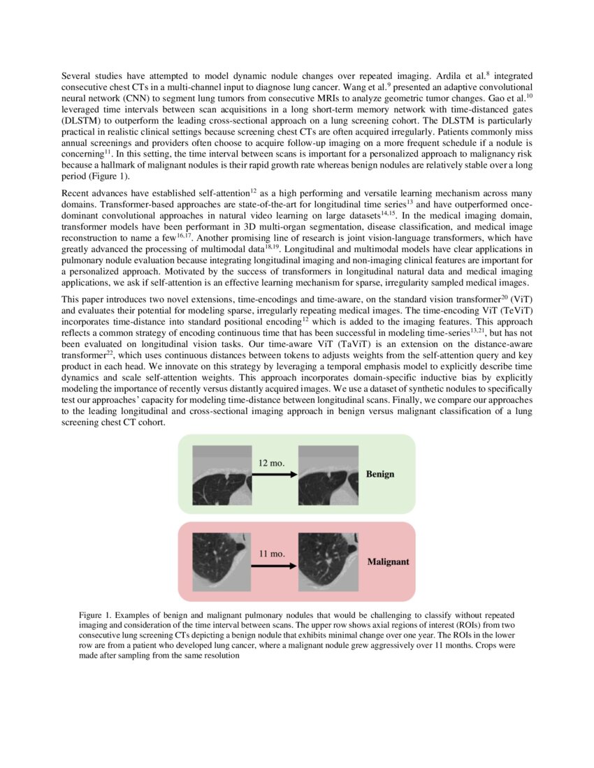 Time-distance vision transformers in lung cancer diagnosis from ...