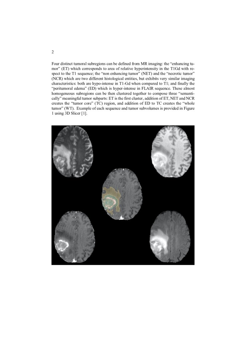 Top 10 BraTS 2020 challenge solution: Brain tumor segmentation with ...