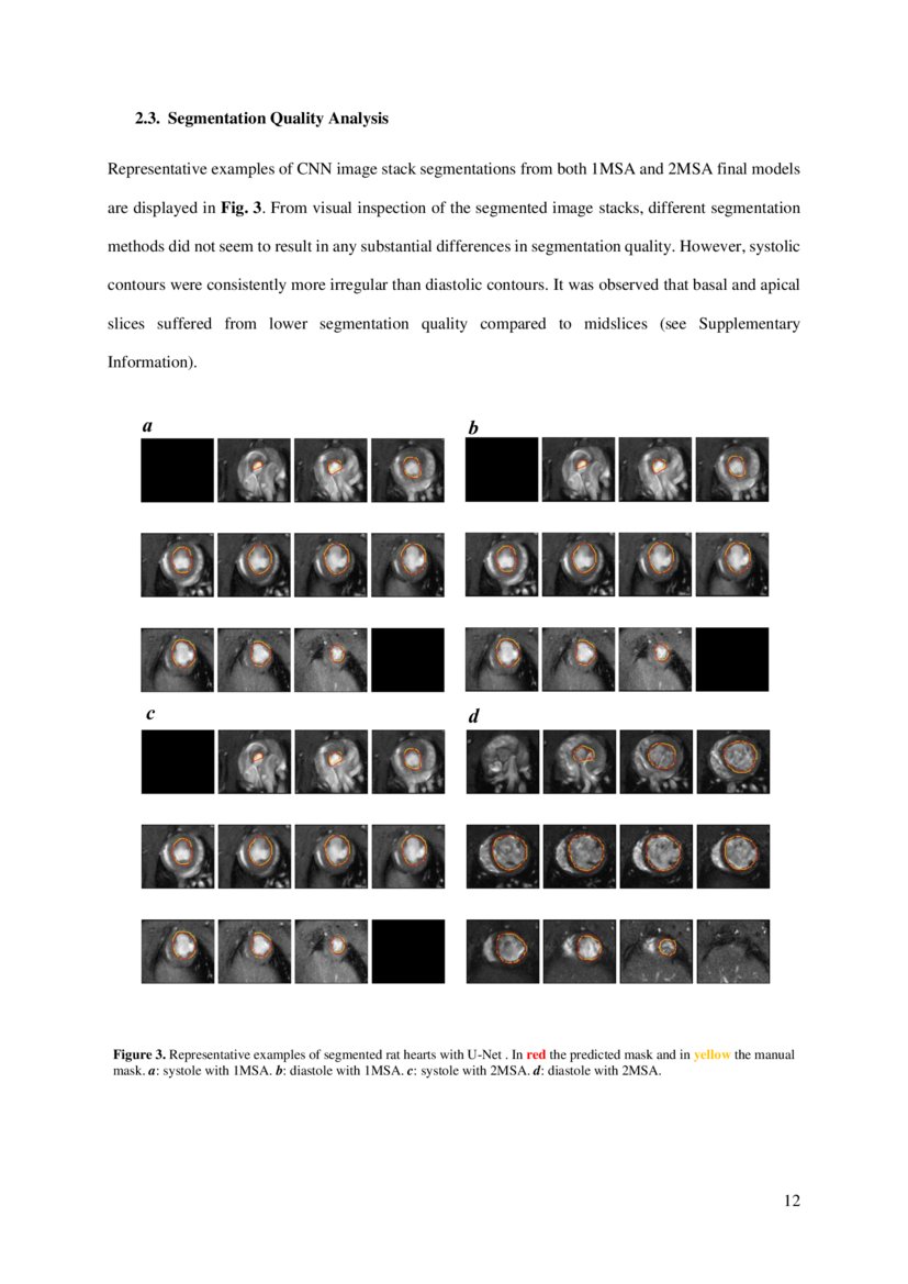 Towards Fully Automated Segmentation Of Rat Cardiac Mri By Leveraging Deep Learning Frameworks