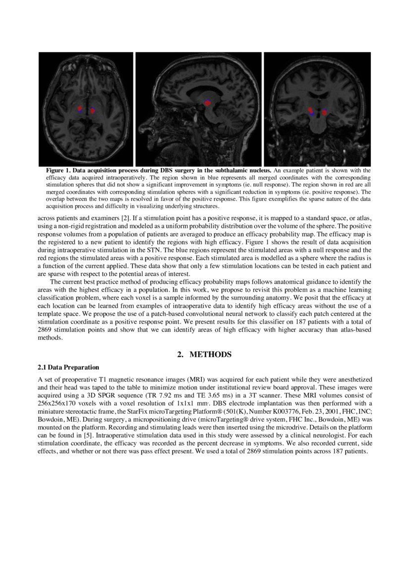 Towards Machine Learning Prediction of Deep Brain Stimulation (DBS ...