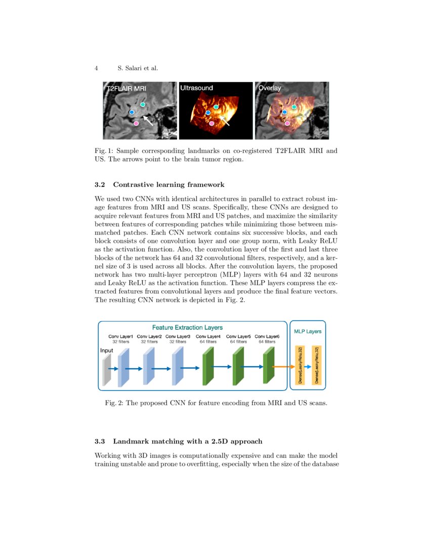 Towards Multi Modal Anatomical Landmark Detection For Ultrasound Guided Brain Tumor Resection