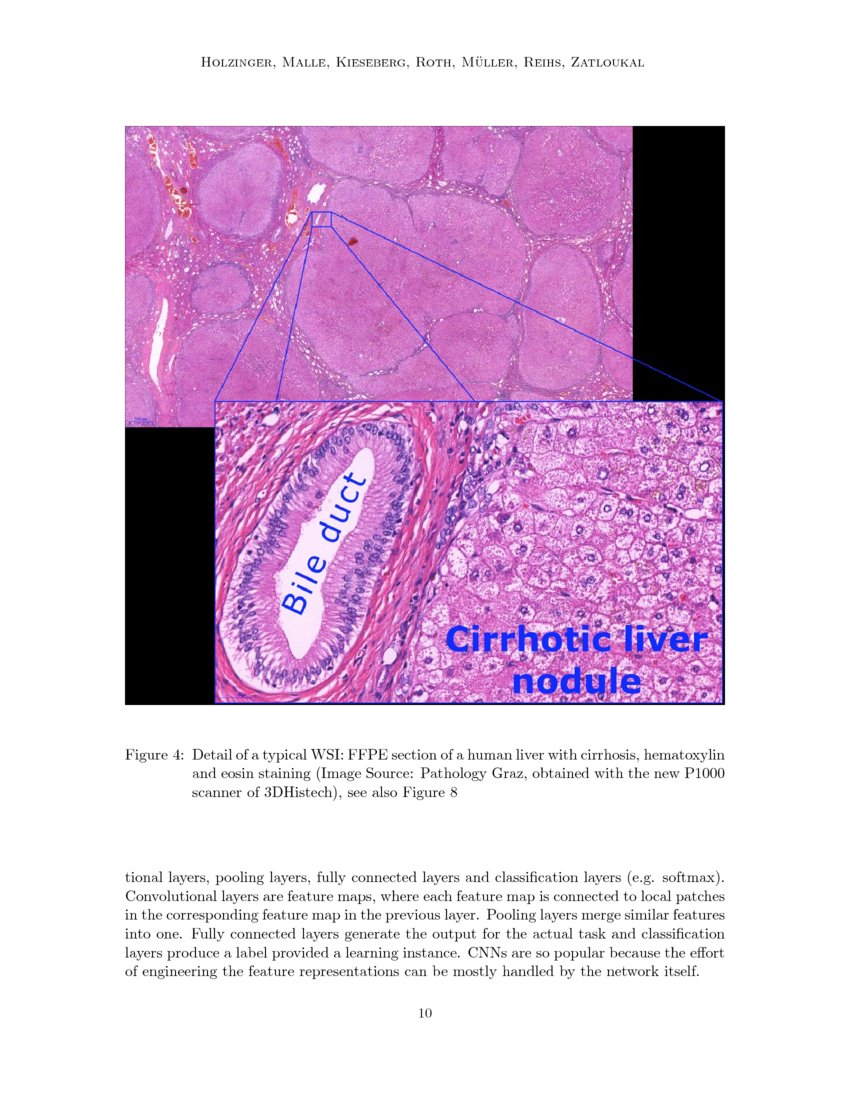 Towards the Augmented Pathologist: Challenges of Explainable-AI in ...