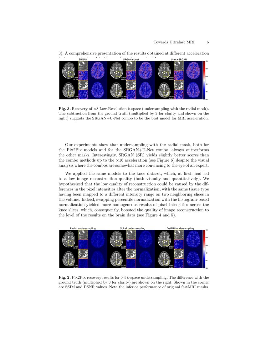 Towards Ultrafast MRI via Extreme k-Space Undersampling and ...