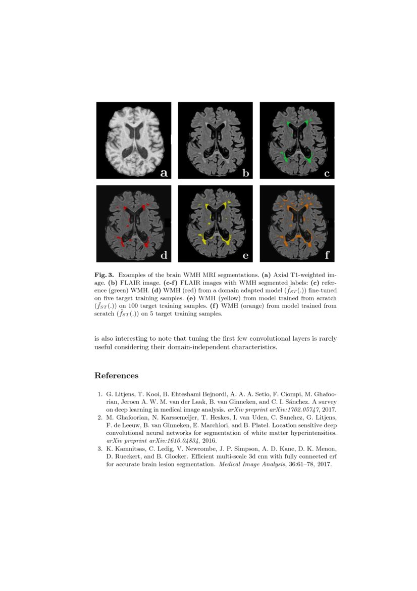 Transfer Learning for Domain Adaptation in MRI: Application in Brain ...