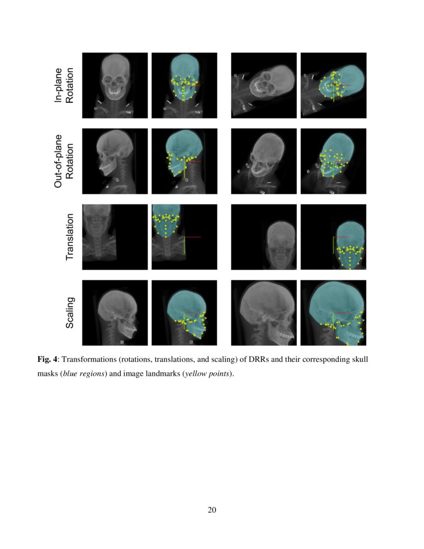 Transfer Learning from an Artificial Radiograph-landmark Dataset for ...