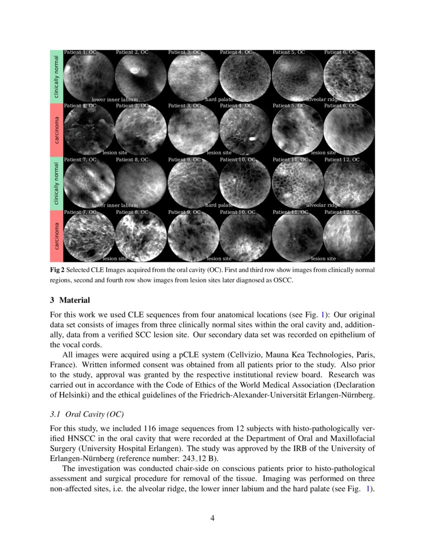 Transferability Of Deep Learning Algorithms For Malignancy Detection In