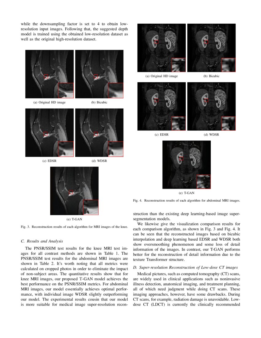 Transformer And Gan Based Super Resolution Reconstruction Network For Medical Images Deepai