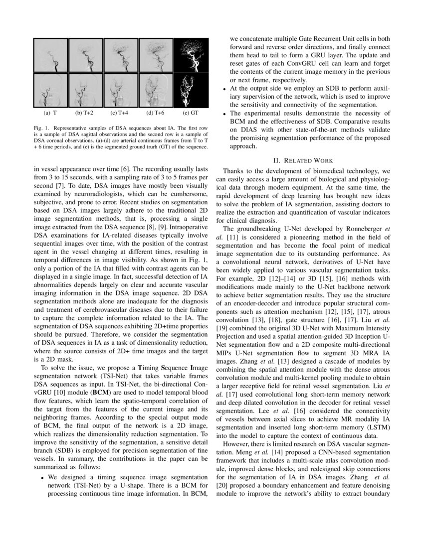 TSI-Net: A Timing Sequence Image Segmentation Network for Intracranial Artery Segmentation in ...