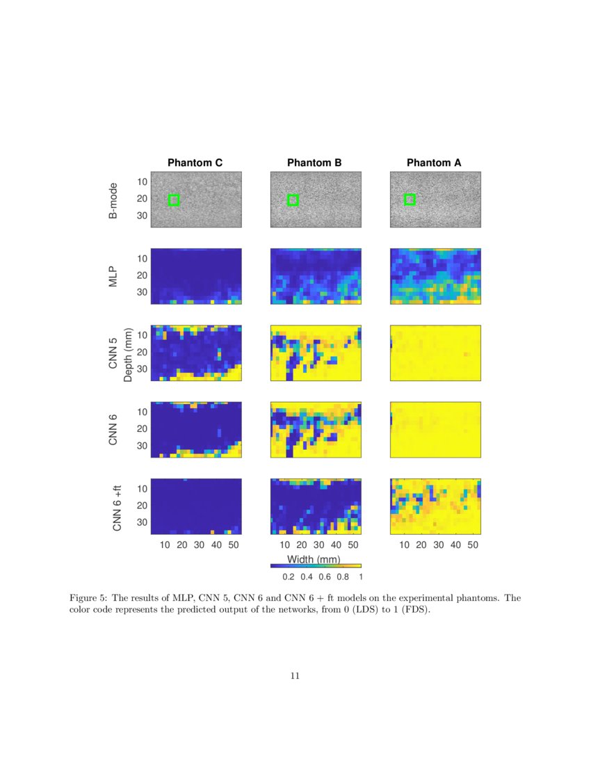 Ultrasound Scatterer Density Classification Using Convolutional Neural Networks by Exploiting ...