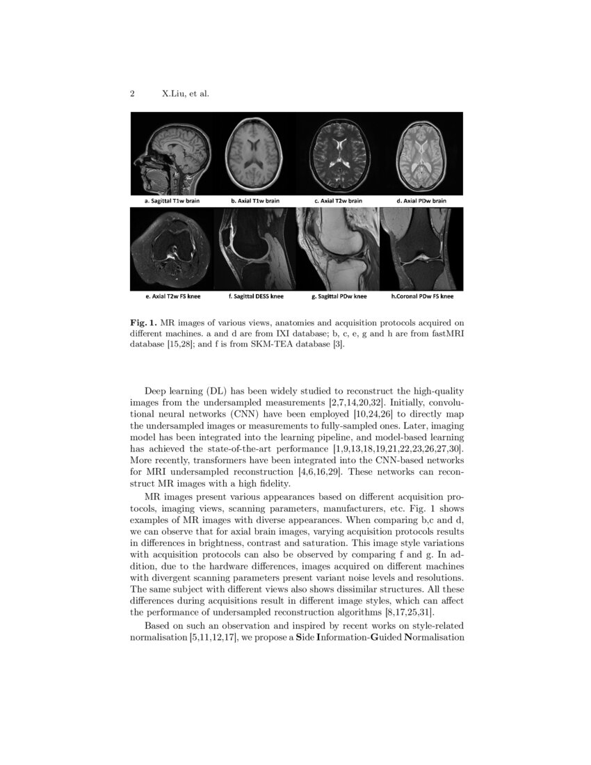 Undersampled MRI Reconstruction with Side Information-Guided ...