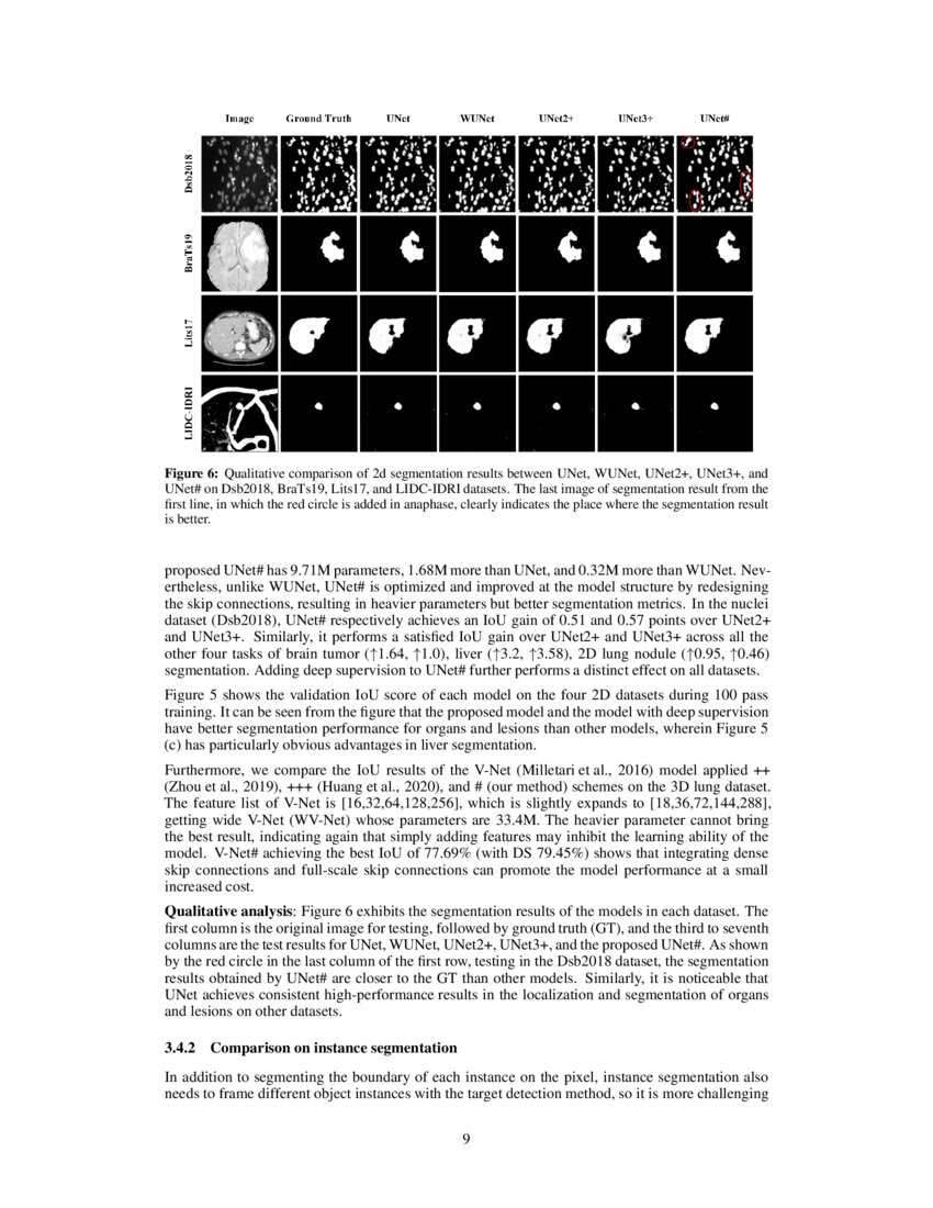 UNet#: A UNet-like Redesigning Skip Connections for Medical Image Segmentation | DeepAI