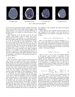 Unsupervised Acute Intracranial Hemorrhage Segmentation with Mixture Models | DeepAI