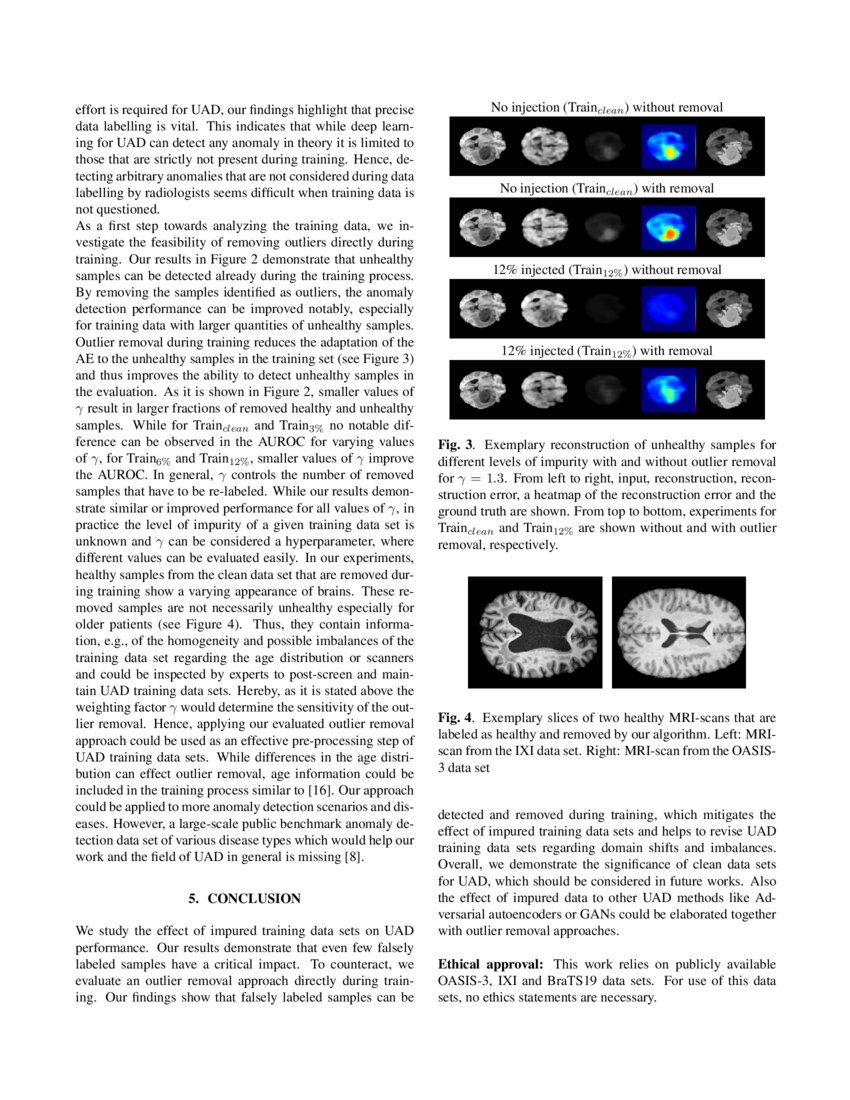 Unsupervised Anomaly Detection In 3d Brain Mri Using Deep Learning With Impured Training Data