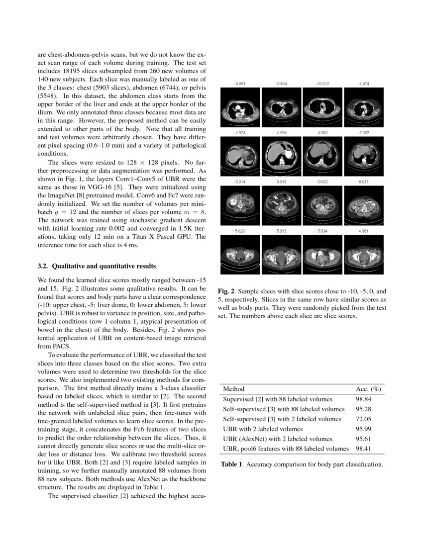 Unsupervised body part regression using convolutional neural network ...
