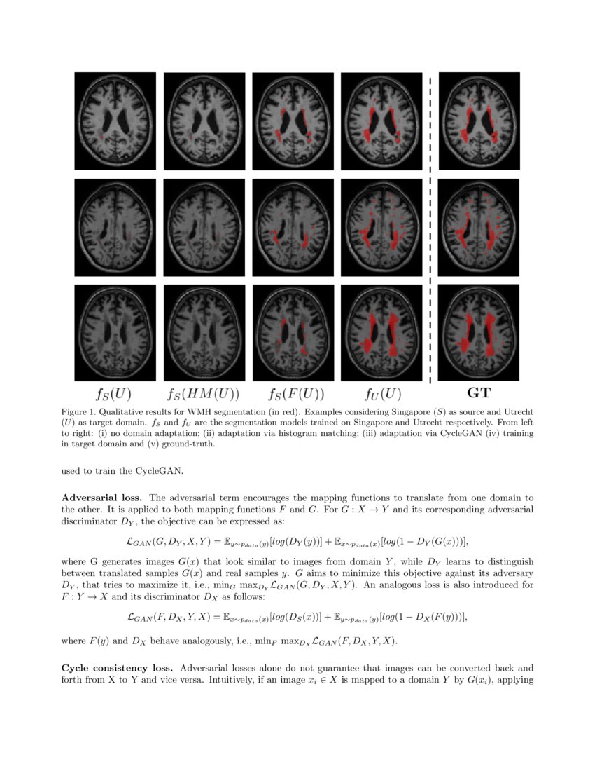 Unsupervised Domain Adaptation via CycleGAN for White Matter Hyperintensity Segmentation in ...