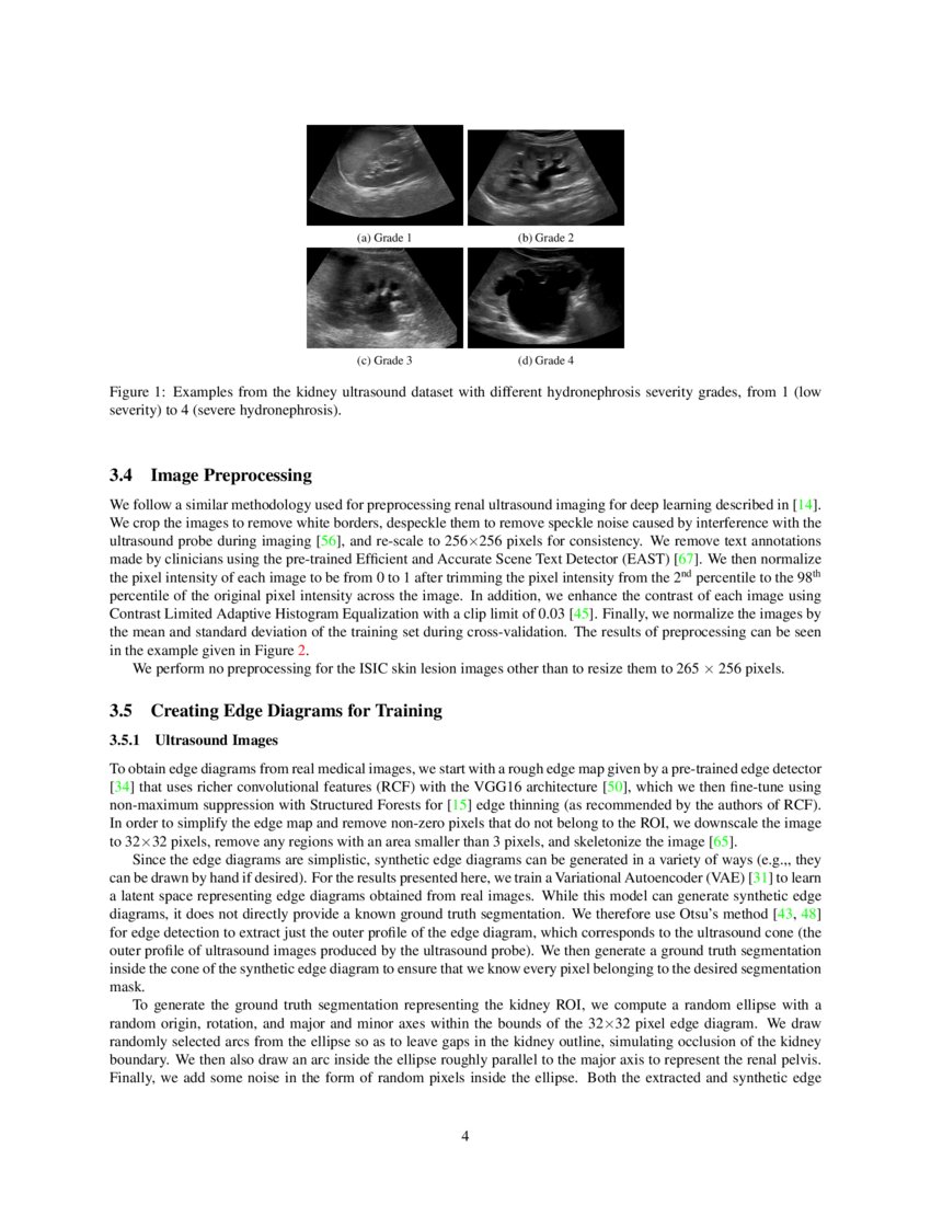 Unsupervised Medical Image Segmentation With Adversarial Networks From