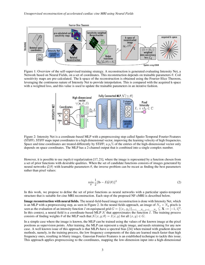 Unsupervised reconstruction of accelerated cardiac cine MRI using ... Unsupervised reconstruction of accelerated cardiac cine MRI using ...