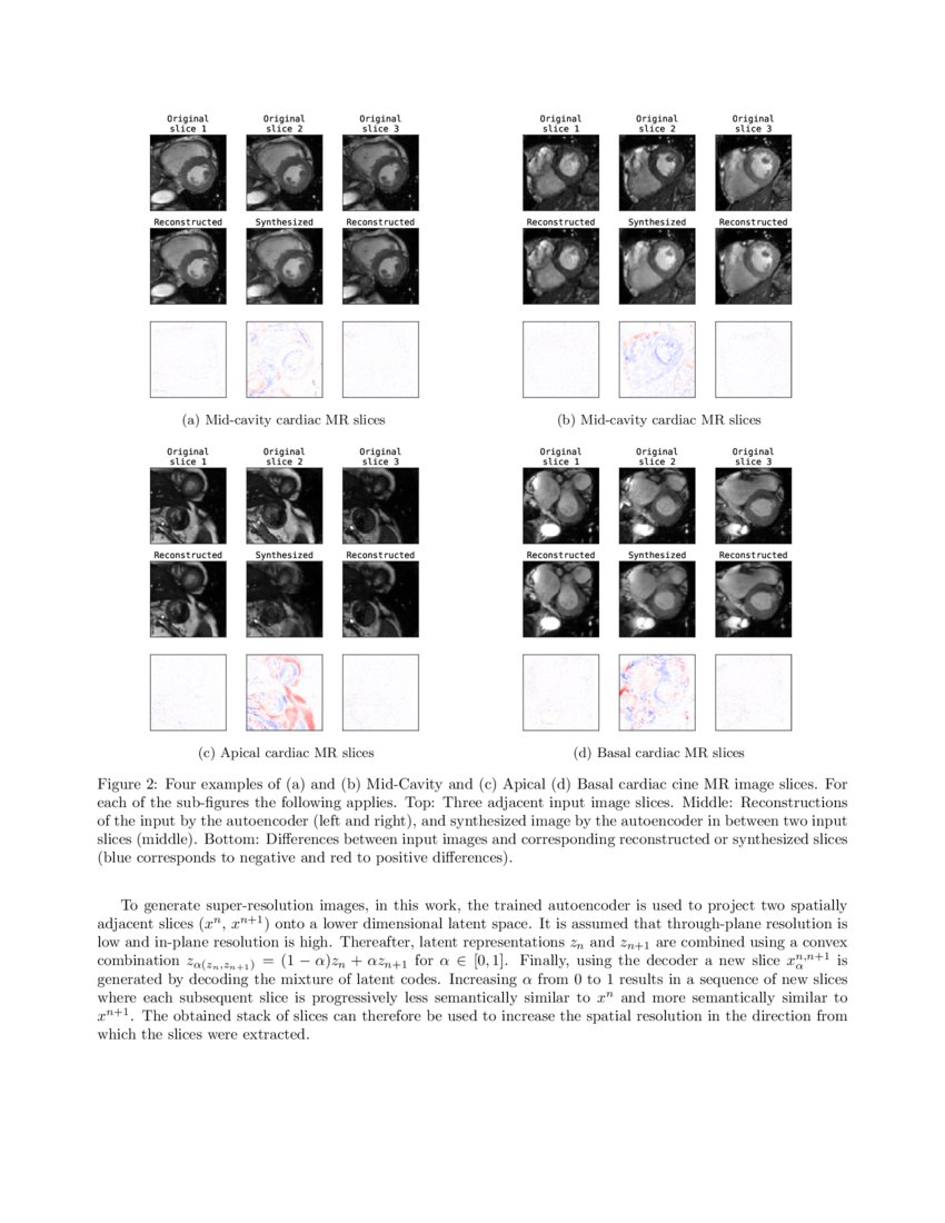 Unsupervised Super-Resolution: Creating High-Resolution Medical Images ...