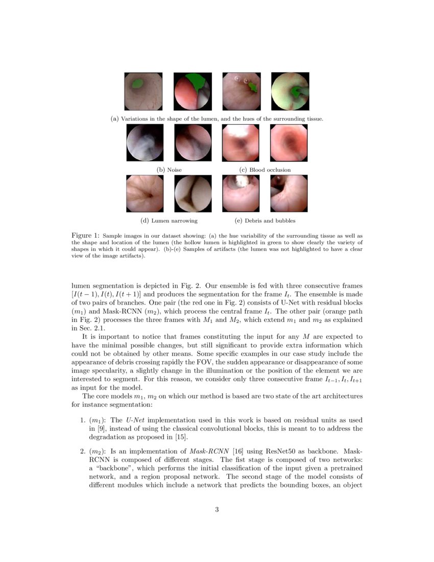 Using Spatial Temporal Ensembles Of Convolutional Neural Networks For