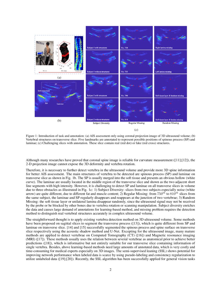 VertMatch: A Semi-supervised Framework for Vertebral Structure ...