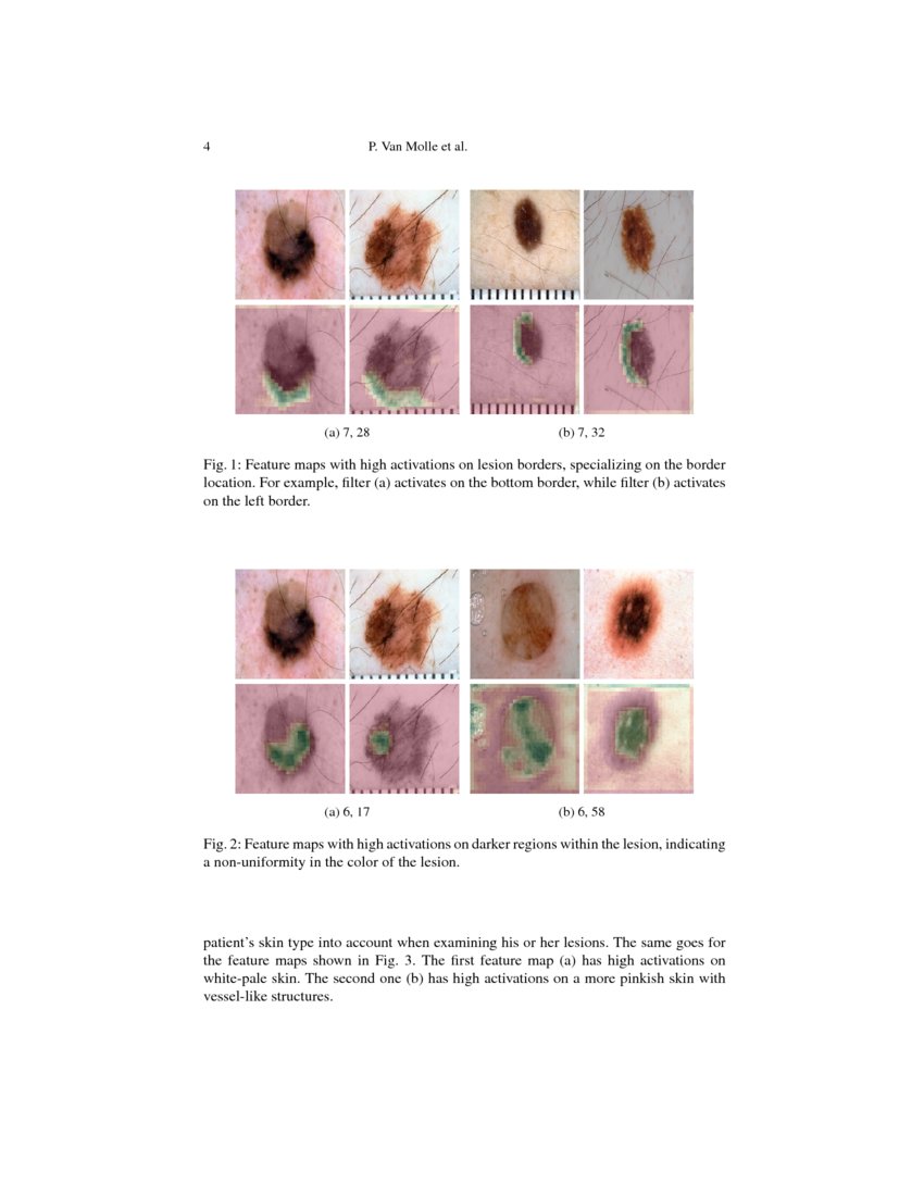 Visualizing Convolutional Neural Networks To Improve Decision Support