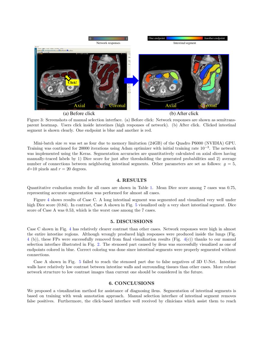 Visualizing intestines for diagnostic assistance of ileus based on ...