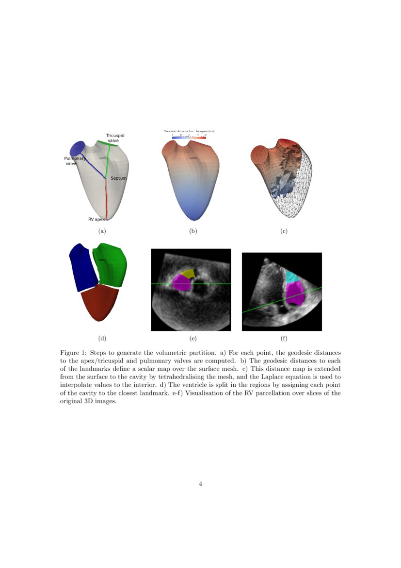 Volumetric parcellation of the right ventricle for regional geometric ...