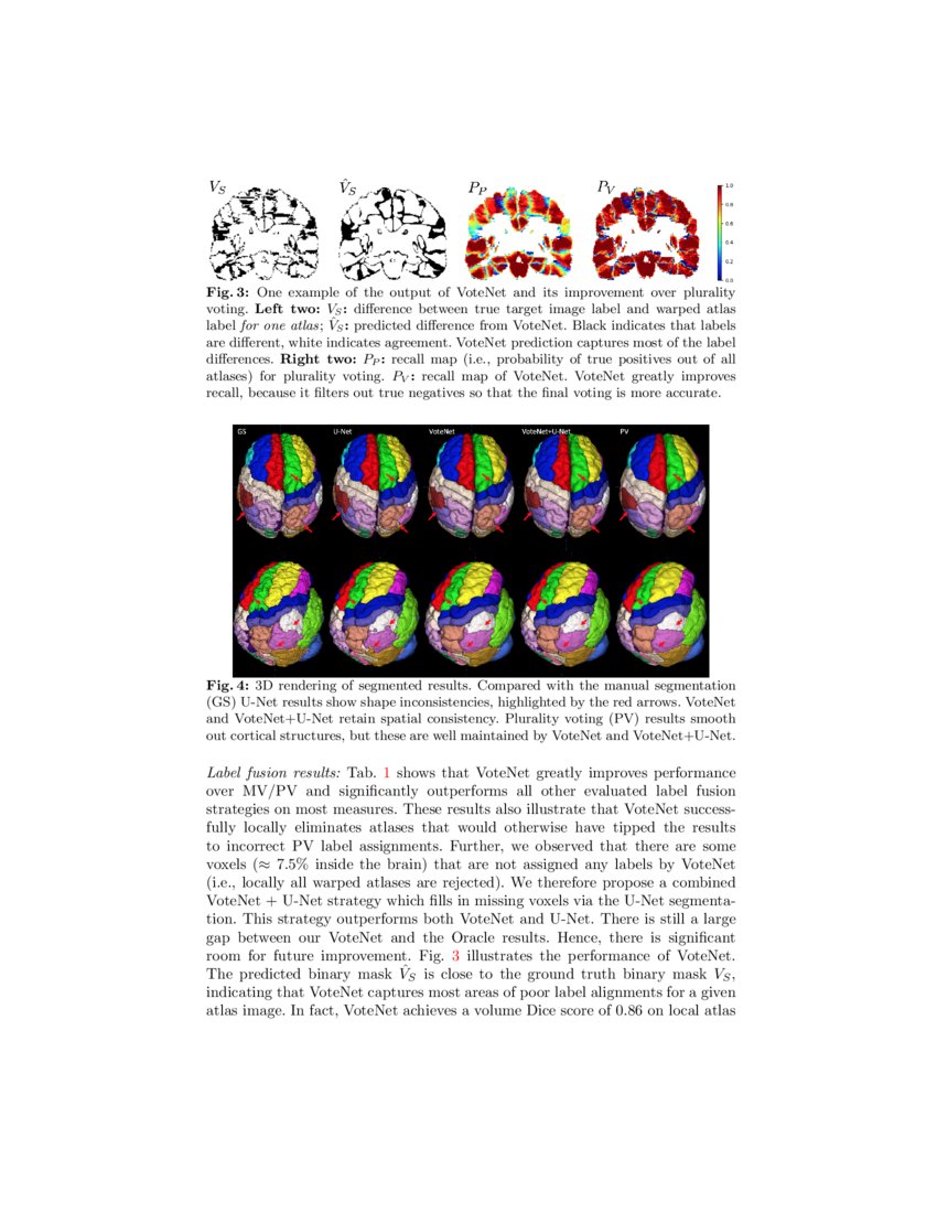VoteNet: A Deep Learning Label Fusion Method for Multi-Atlas Segmentation | DeepAI