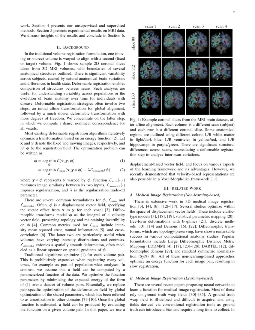 VoxelMorph: A Learning Framework for Deformable Medical Image Registration | DeepAI