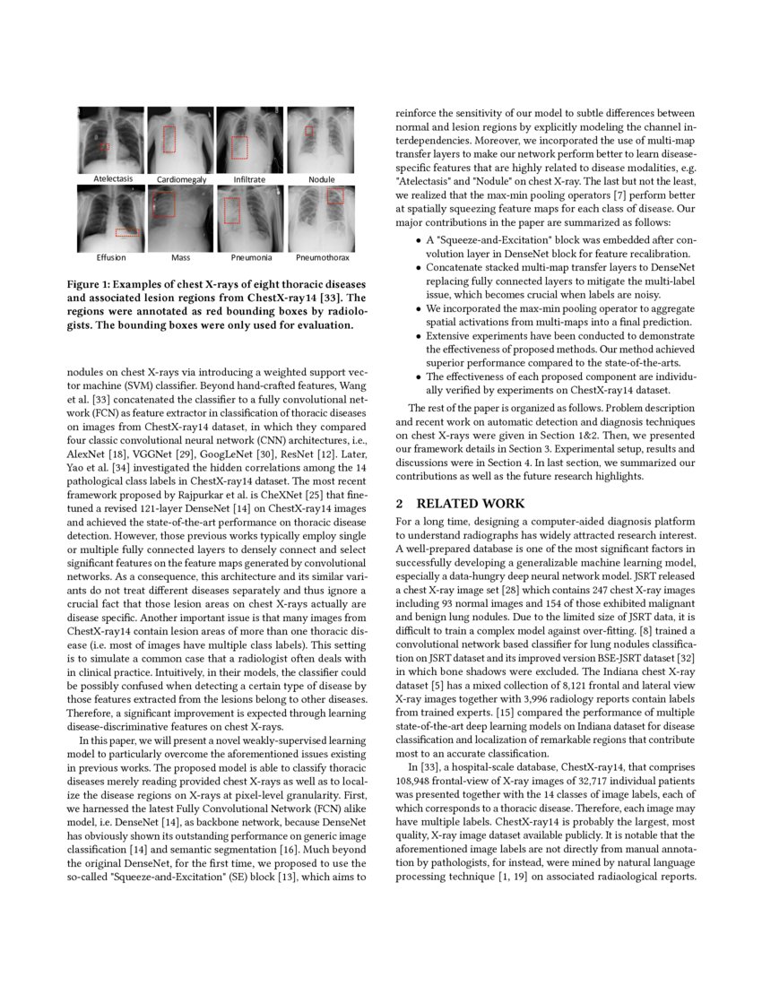 Weakly Supervised Deep Learning For Thoracic Disease Classification And Localization On Chest X 