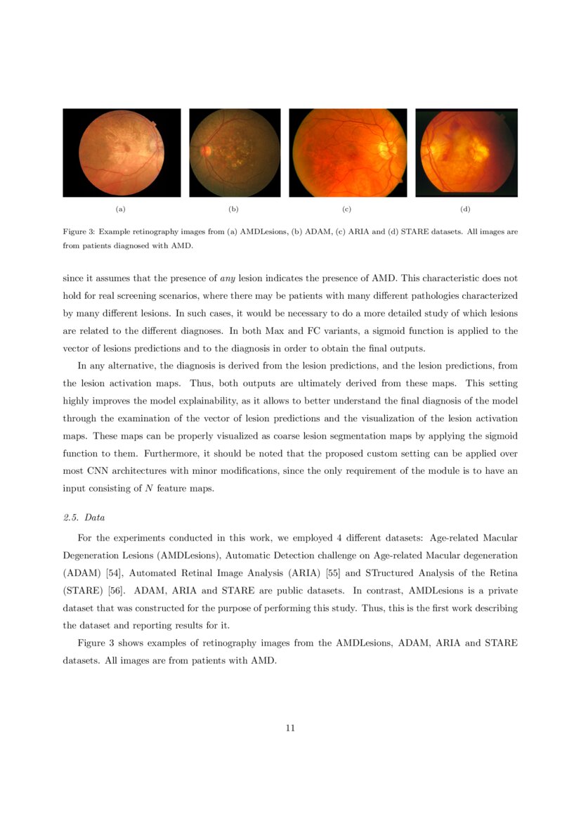 Weakly Supervised Detection Of Amd Related Lesions In Color Fundus Images Using Explainable Deep