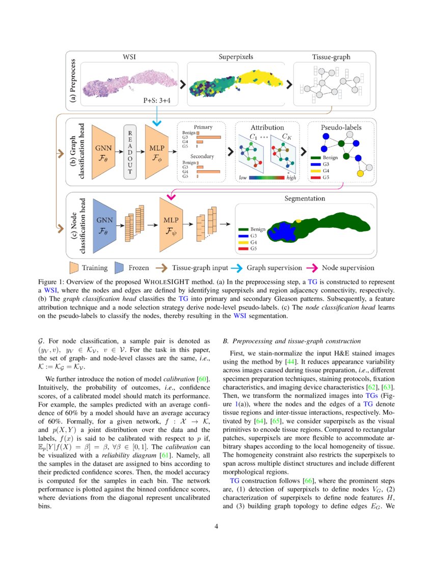 Weakly Supervised Joint Whole Slide Segmentation And Classification In