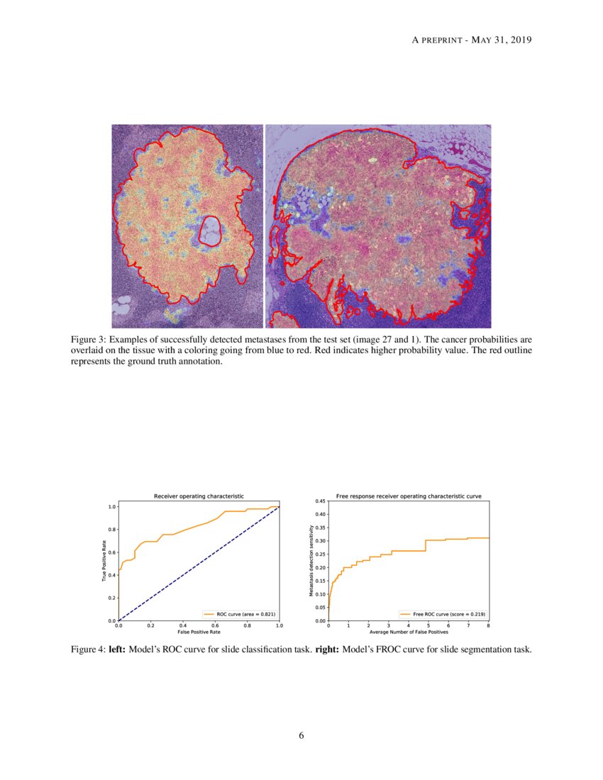 Weakly Supervised Training Of Pixel Resolution Segmentation Models On Whole Slide Images Deepai 