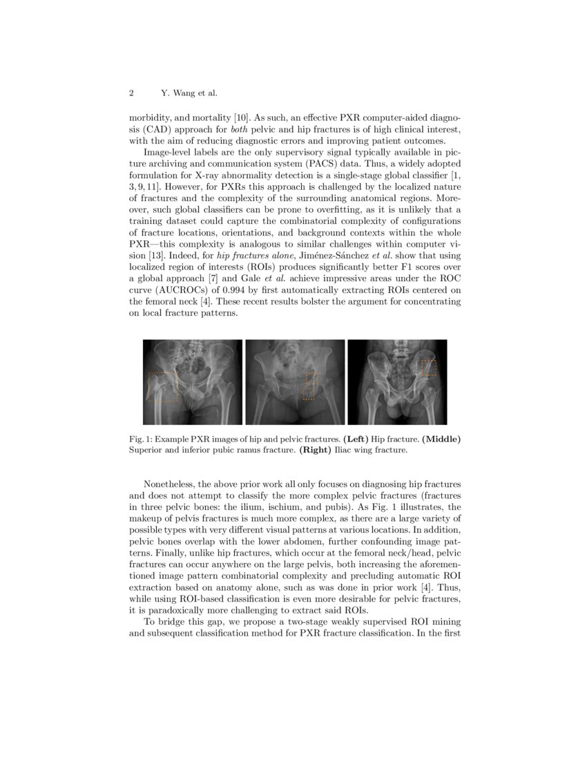 Weakly Supervised Universal Fracture Detection in Pelvic X-rays | DeepAI Weakly Supervised Universal Fracture Detection in Pelvic X-rays | DeepAI