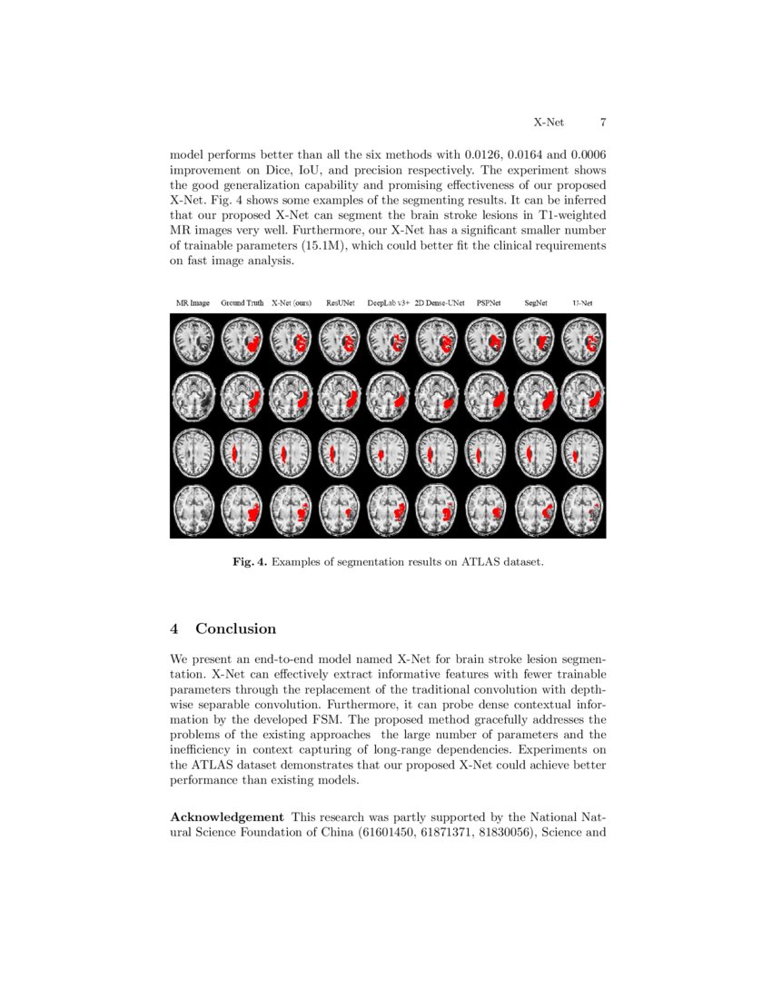 X Net Brain Stroke Lesion Segmentation Based On Depthwise Separable Convolution And Long Range